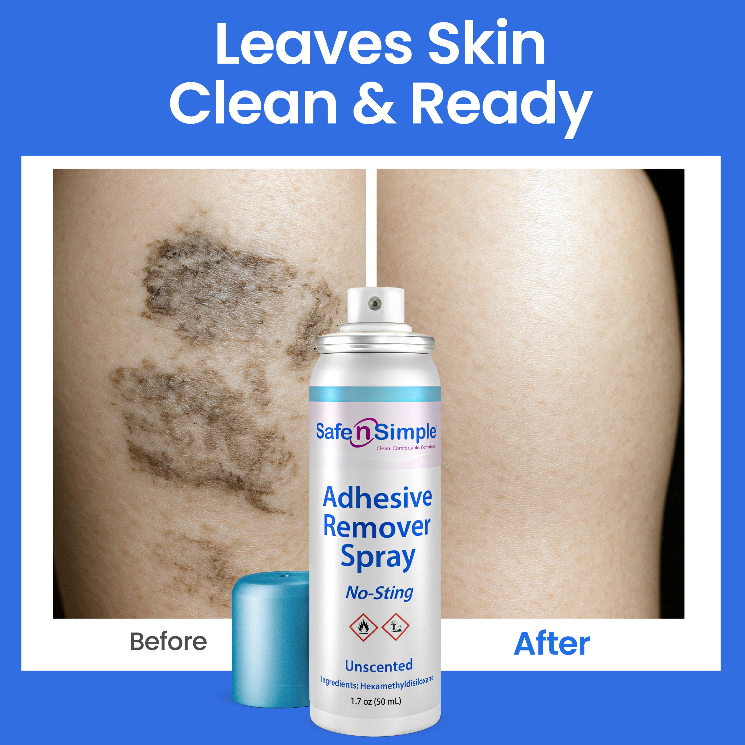 How to Remove Medical Adhesive from Skin Safely - Safe n Simple